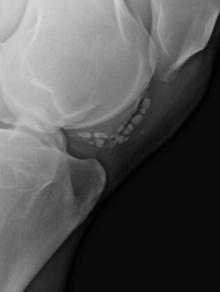 OCD: A very common pathology in horses - Breeding News for Sport Horses